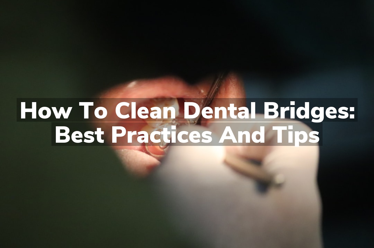 How to Clean Dental Bridges: Best Practices and Tips | Alliance Dental Care